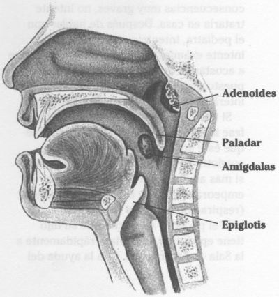 Epiglotitis (niños) | Muy Visitado